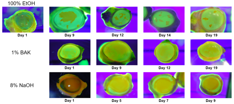 Understanding the HET-CAM Test: An Alternative Approach to Eye ...